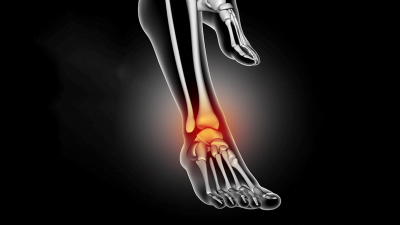 Bol u peti : uzroci, simptomi i liječenje - Dr Komfort